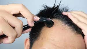 דרמה רולר - מינוקס ישראל - Minox IL